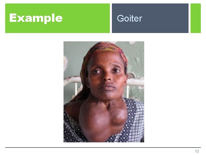 Hypothyroidism By Michelle Russell 1 Objectives o To