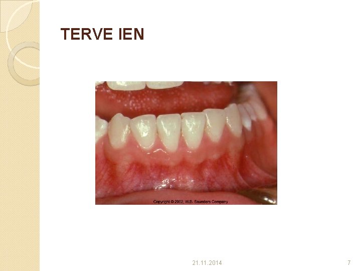 SUUNHOITO PERUSHOIDOSSA Tt M suuhygienisti Kirsi AutonenHonkonen nekosken