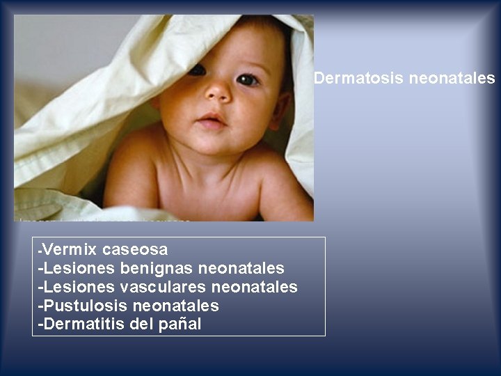 DERMATOSIS NEONATALES Dra Susana Habermacher CATEDRA DE DERMATOLOGIA