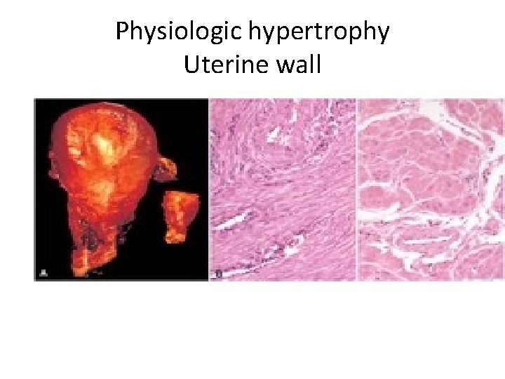 Introduction to pathology lecture 1 Fatima Obeidat MD