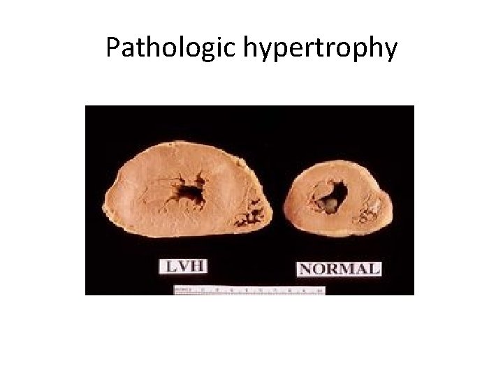 Introduction to pathology lecture 1 Fatima Obeidat MD