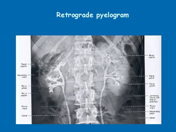 Morphology and histology of the urinary passages pelvis