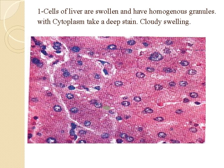 Cellular injury Introduction 3 rd stage MSc Etab