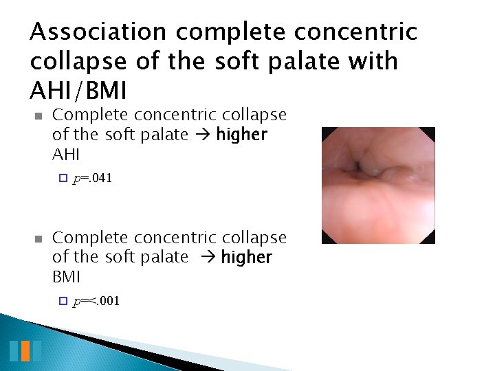 Logistics and Relevance of Drug Induced Sleep Endoscopy
