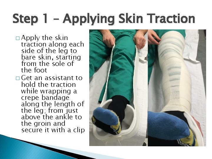 THOMAS SPLINT Dean Salmon 40077459 Indications for use