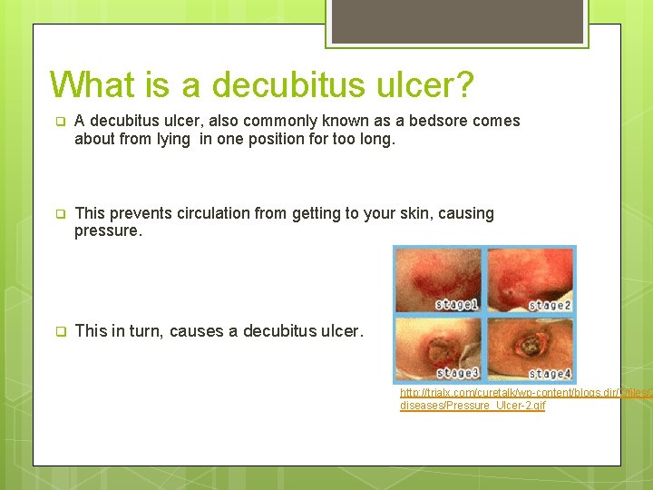 The Truth about Decubitus Ulcers Created By Kelsey