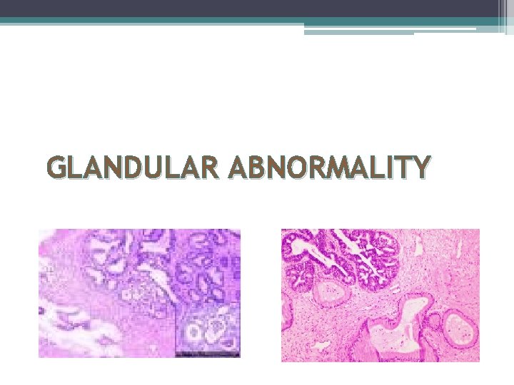 MANAGEMENT OF ABNORMAL PAP SMEAR DR ALIFAH BT