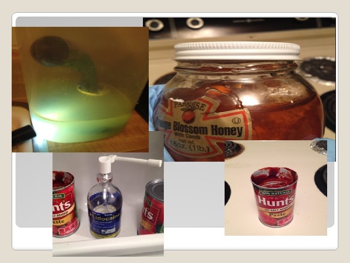 Botulism in the Panhandle Botulism Investigation City of
