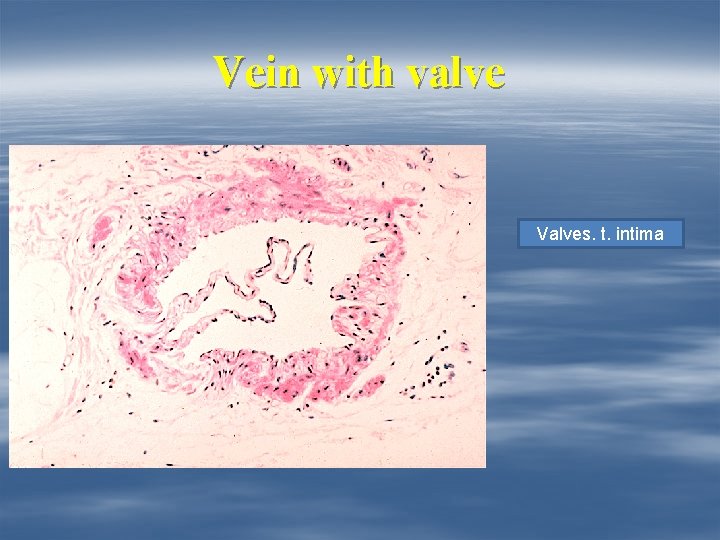 Blood Anna L Kiss Department of Anatomy Histology