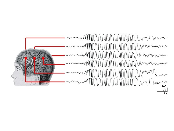 DC Potential and the Brain Ali Gorji Epilepsy