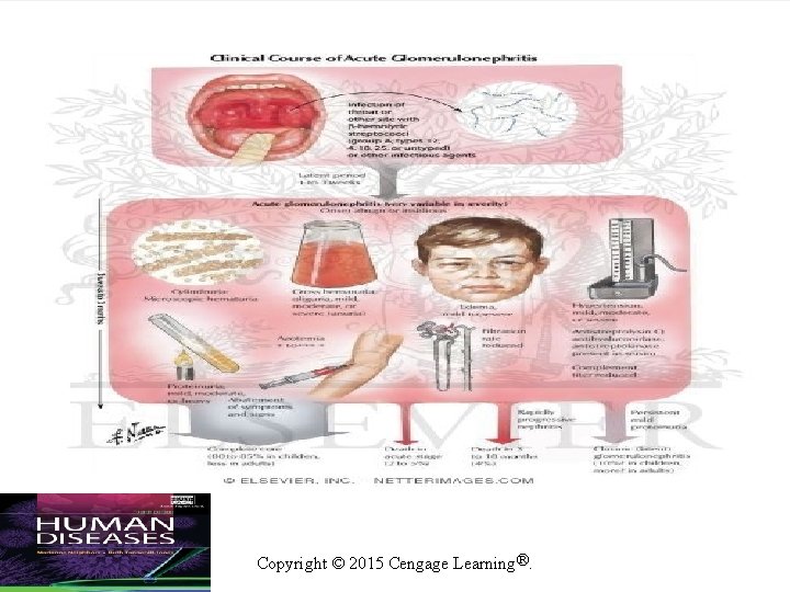 Chapter 13 Urinary System Diseases and Disorders Copyright