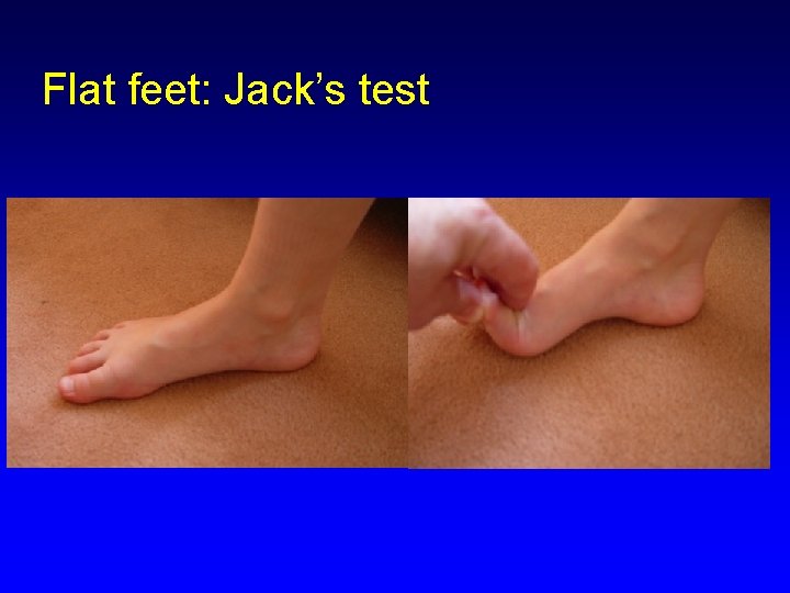 Normal and abnormal in Paediatric Orthopaedics what should