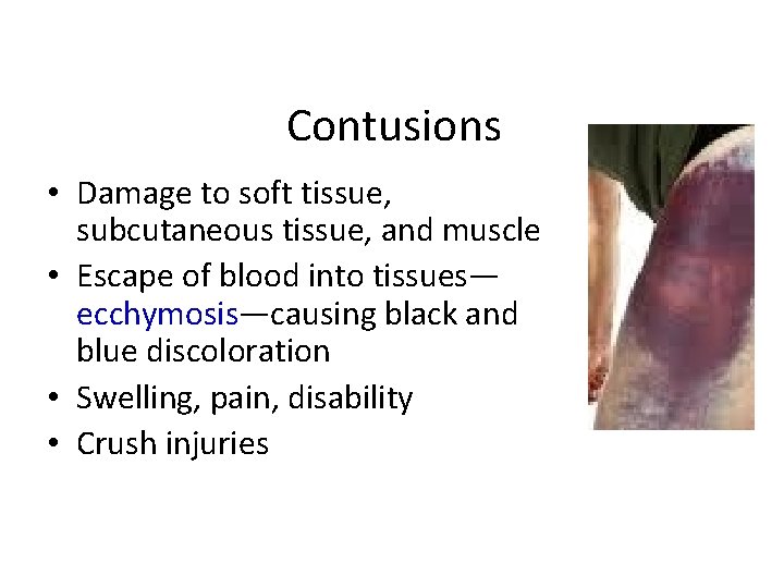Chapter 23 Musculoskeletal Disorders Review Slides for Children