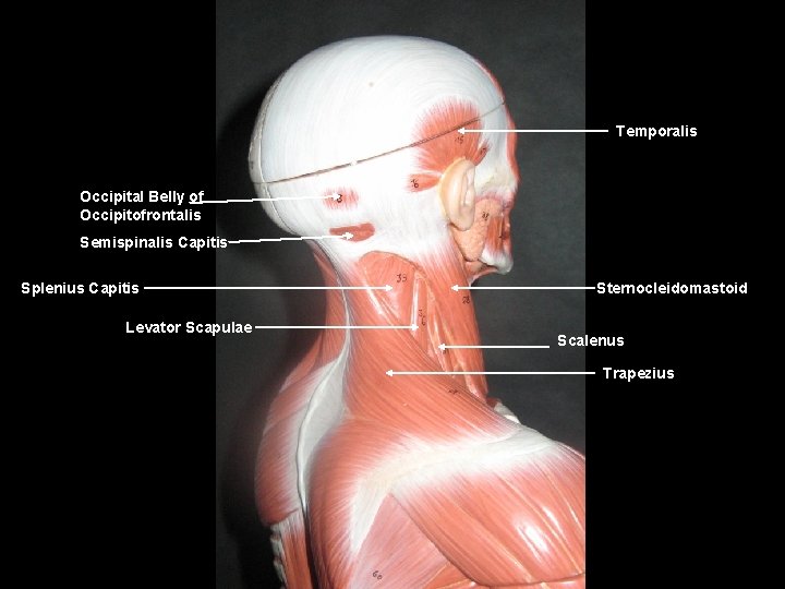 Muscles of the Human Body By Chandra Allen
