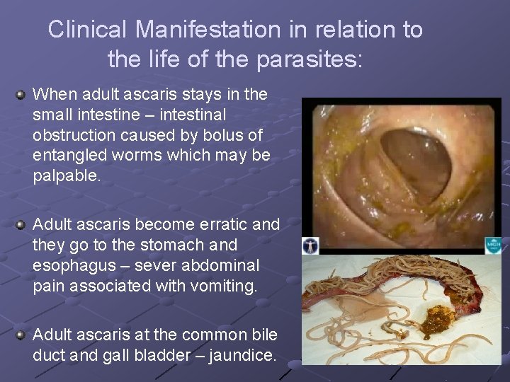 ASCARIASIS Roundworm Infection Definition Infection caused by parasite