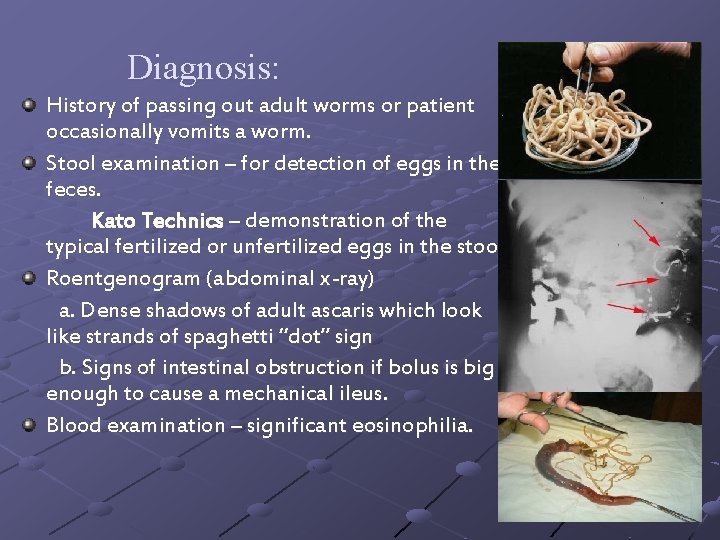 ASCARIASIS Roundworm Infection Definition Infection caused by parasite