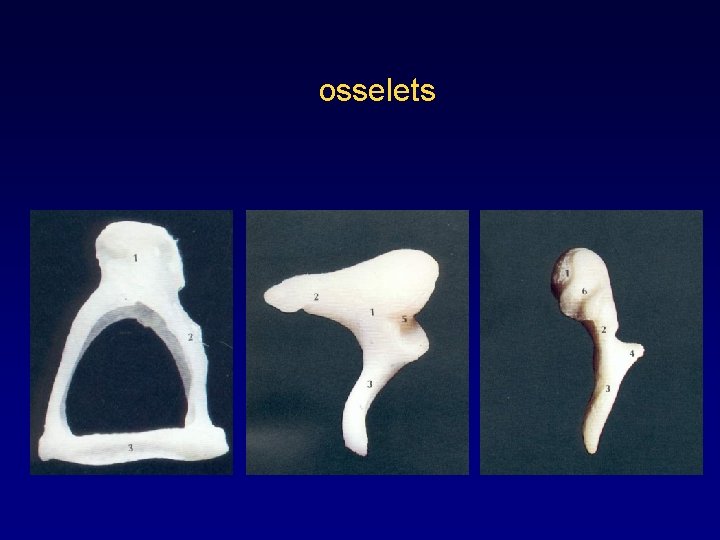 Rappel anatomique u Otoscopie u Diffrents types de