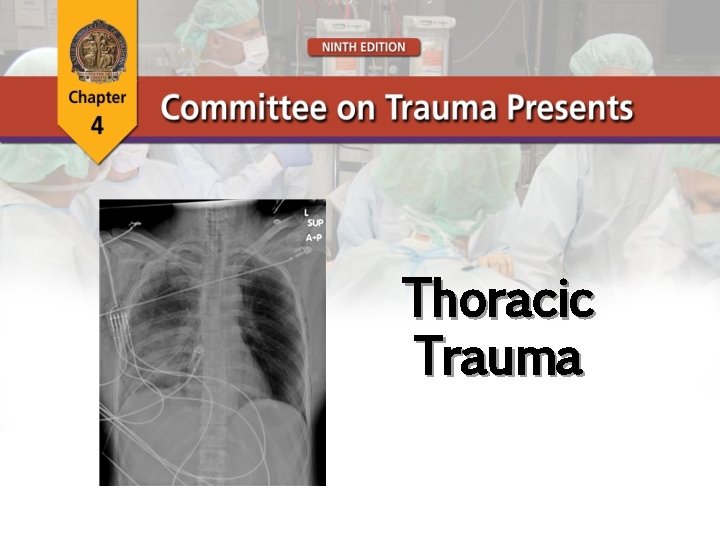Thoracic Trauma Initial Assessment and Management Chapter Statement