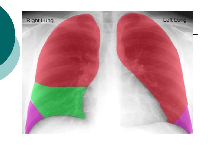 Chest Auscultation FOUR COMPONENTS OF A RESPIRATORY ASSESSMENT
