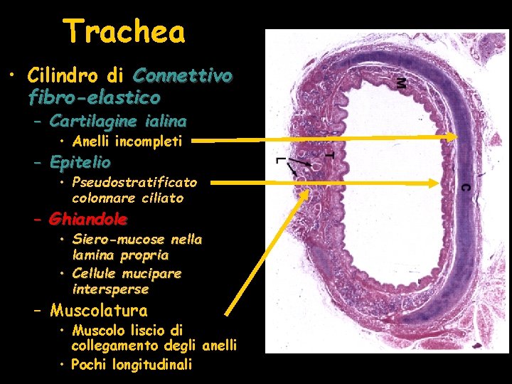 Sistema Respiratorio Cavit Nasale Cavit Orale Bronco primario