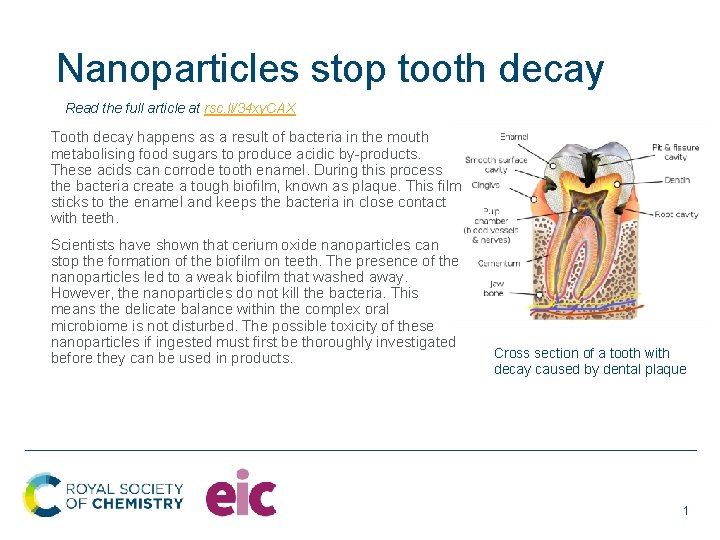 Nanoparticles stop tooth decay Read the full article