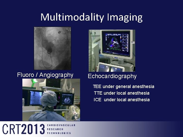 CHU Bichat Claude Bernard Is Transoesophageal Echocardiography during