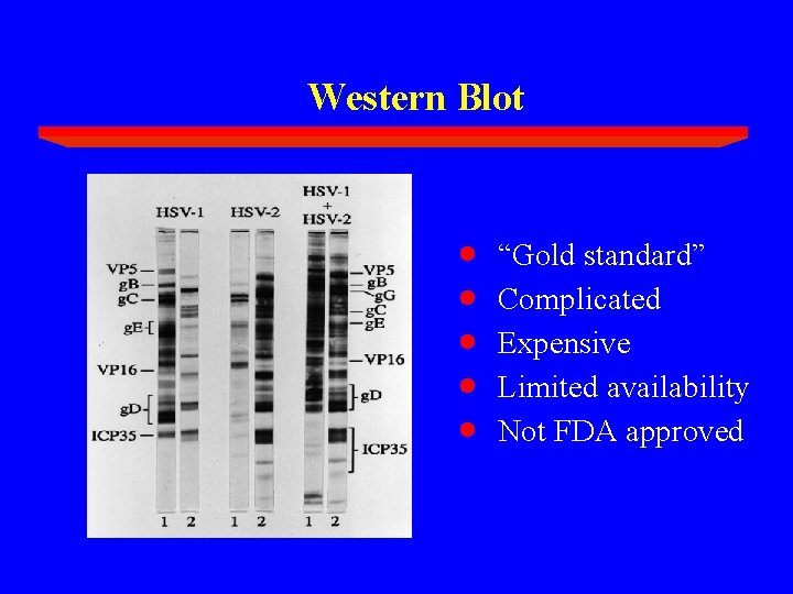 Laboratory Diagnosis of HSV Infection Peter Leone MD