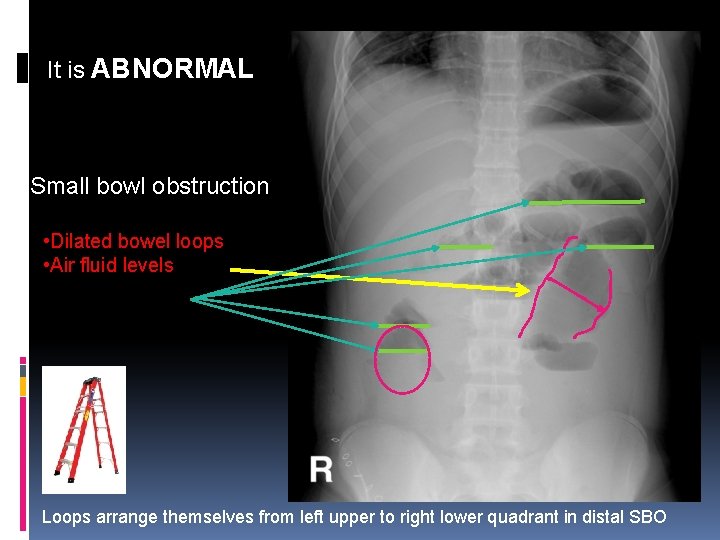 RADIOLOGY OF THE ABDOMEN Abdulaziz almanie MD Radiology