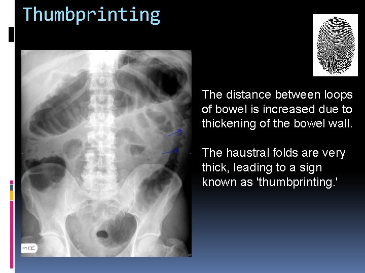 RADIOLOGY OF THE ABDOMEN Abdulaziz almanie MD Radiology