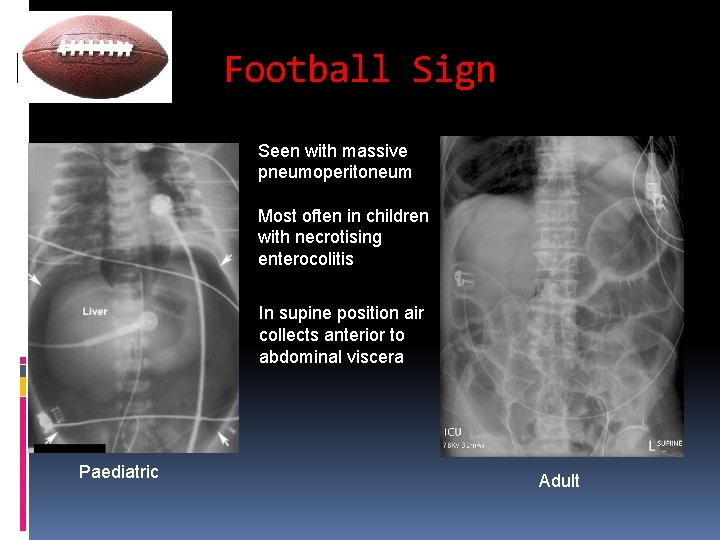 RADIOLOGY OF THE ABDOMEN Abdulaziz almanie MD Radiology