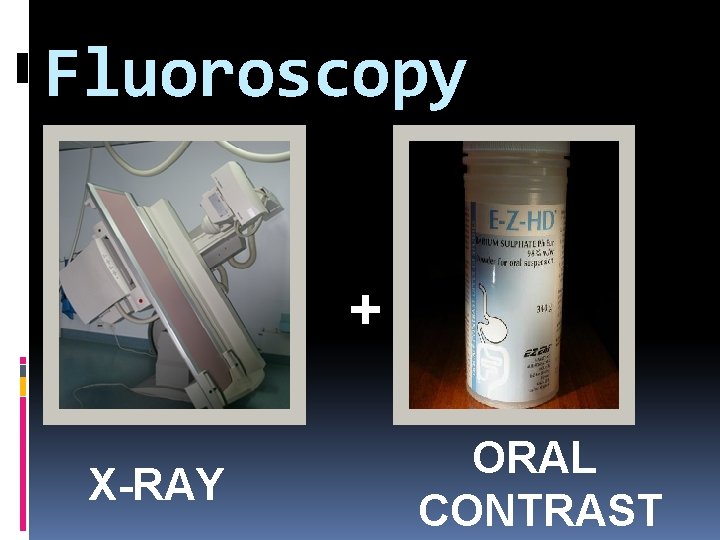 RADIOLOGY OF THE ABDOMEN Abdulaziz almanie MD Radiology