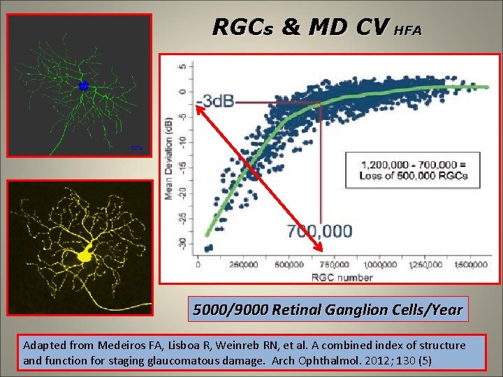 Il Glaucoma OLTRE Tricase 160514 Structure and function