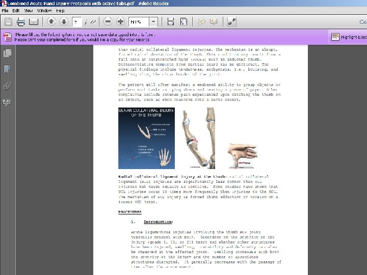 Acute Upper Extremity Injury Protocols Diagnosing and Managing