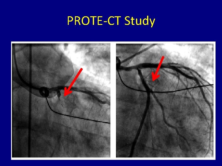 HILLSBOROUGH COUNTY SHERIFFS DEPARTMENT Saving Our Law Officers
