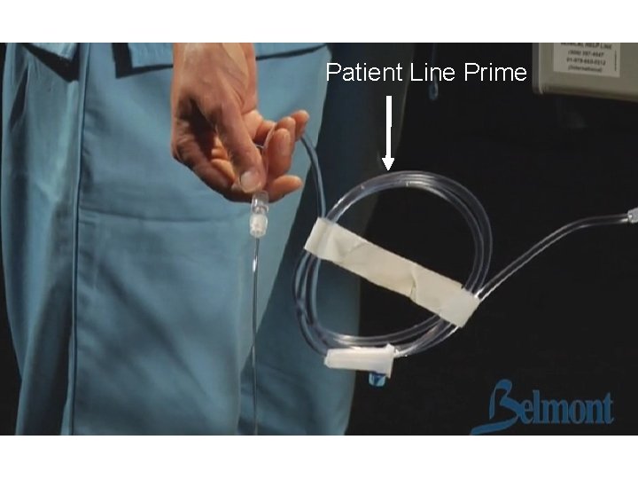 Belmont Setup and Infusion There is a complete