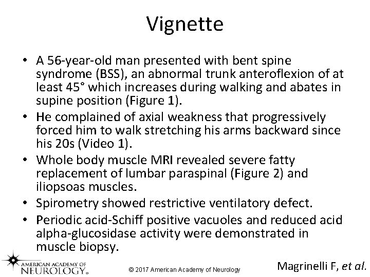 A man with bent spine syndrome Teaching Video