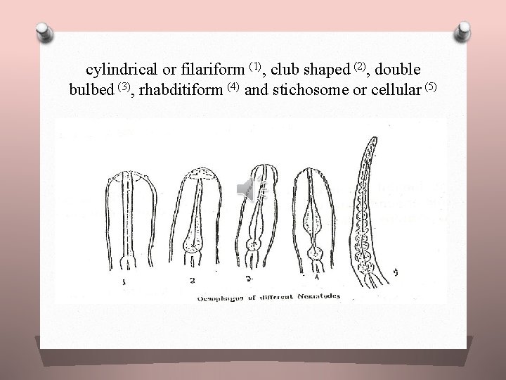 Entrobius vermicularis O Dr Salwa Sami Younis O