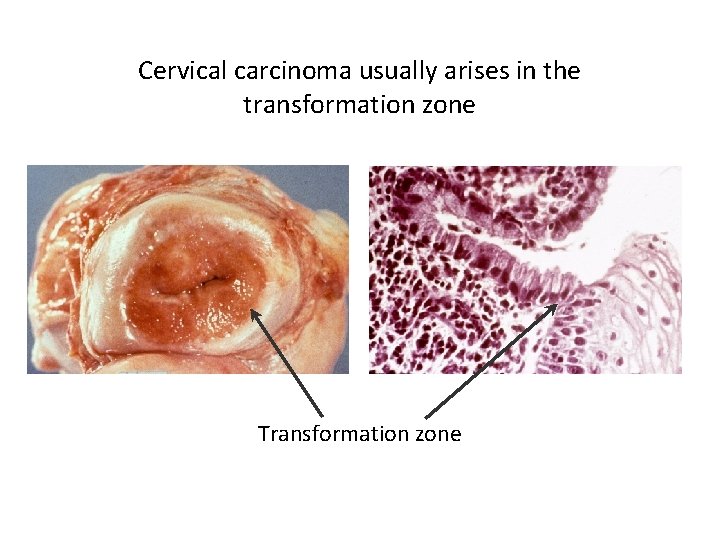 Female Reproductive System Kristine Krafts M D Female