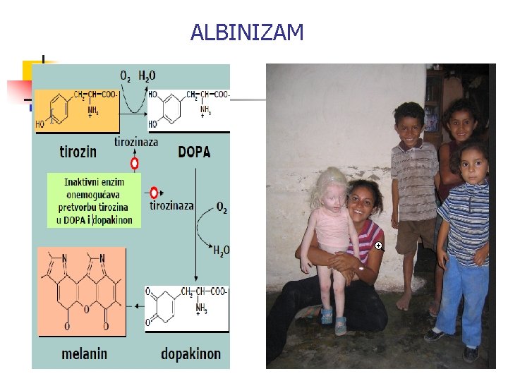 PRIMARNI POREMEAJI METABOLIZMA PROTEINA Doc dr Mirjana MiloeviToi