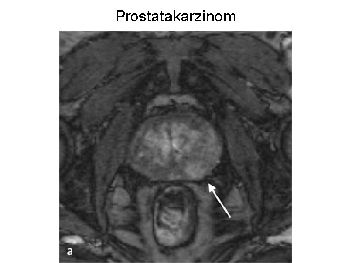 Makroskopische Anatomie der mnnlichen Geschlechtsorgane Hoden ...