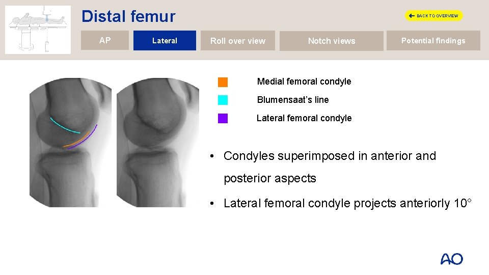 Intraoperative imaging in knee trauma Developed by Mara