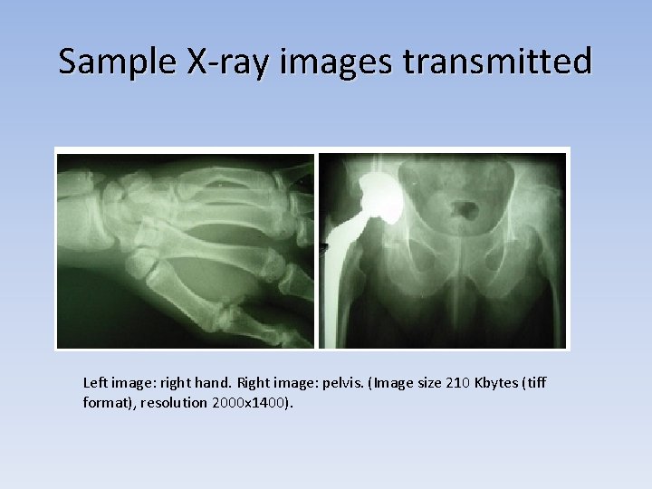 Telemedicine Transfer XRay image and Patient Data through