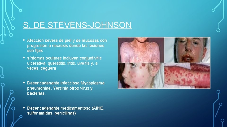 URTICARIA DIAGNOSTICO DIFERENCIAL DRA ADRIANA TQUEZ MUOZ DERMATOLOGA