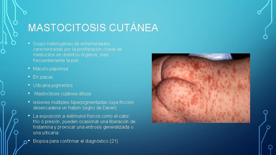 URTICARIA DIAGNOSTICO DIFERENCIAL DRA ADRIANA TQUEZ MUOZ DERMATOLOGA
