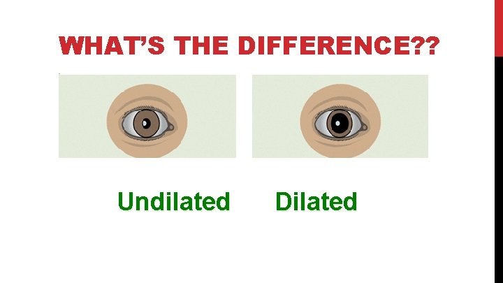 WHATS THE DIFFERENCE Undilated Dilated VOCABULARY Dilation a