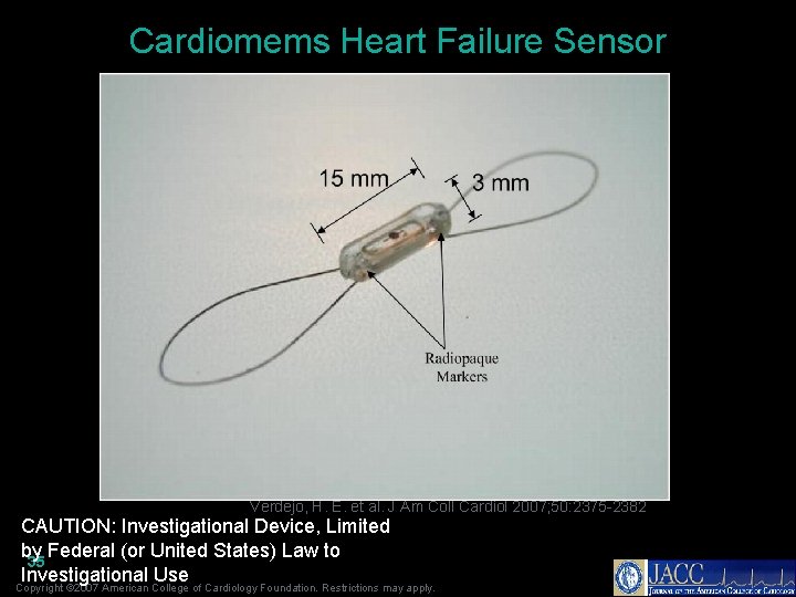 Brief History of Major Advancements in Cardiac Pacing