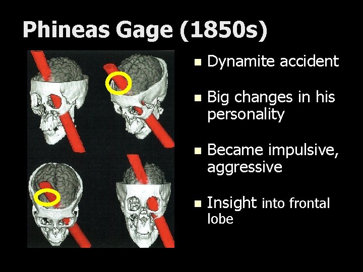 Neuroscience Techniques Intentional brain damage Lesions surgical ...