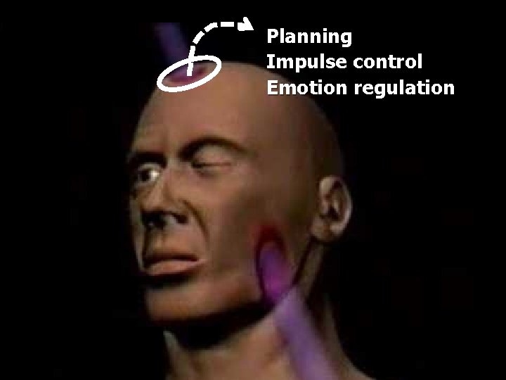 Neuroscience Techniques Intentional brain damage Lesions surgical ...