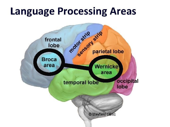 Neuroscience Techniques Intentional brain damage Lesions surgical ...