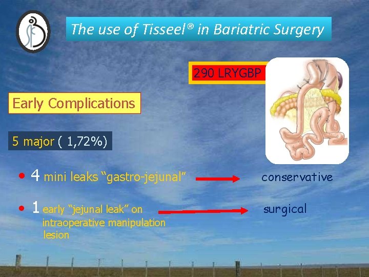 The use of Tisseel in Bariatric Surgery The